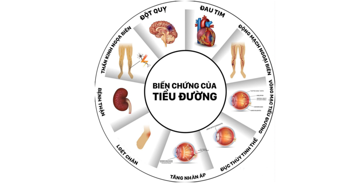 Khuyến Cáo Mới Trong điều Trị đái Tháo đường Cdc Tây Ninh